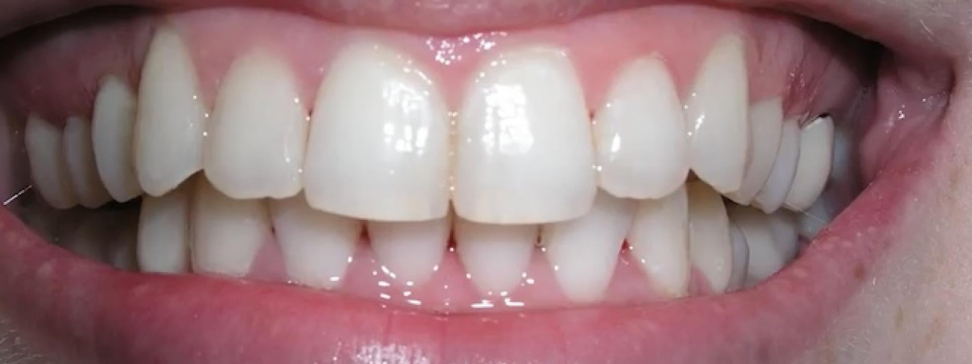 Abbey M. | Always Beautiful Smile