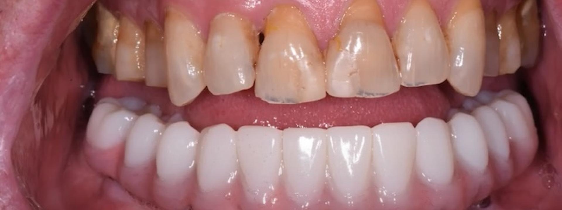 Daniel B. | Always Beautiful Smile